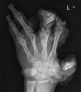 Radiation Exposure in Trauma - Maryland TraumaNET